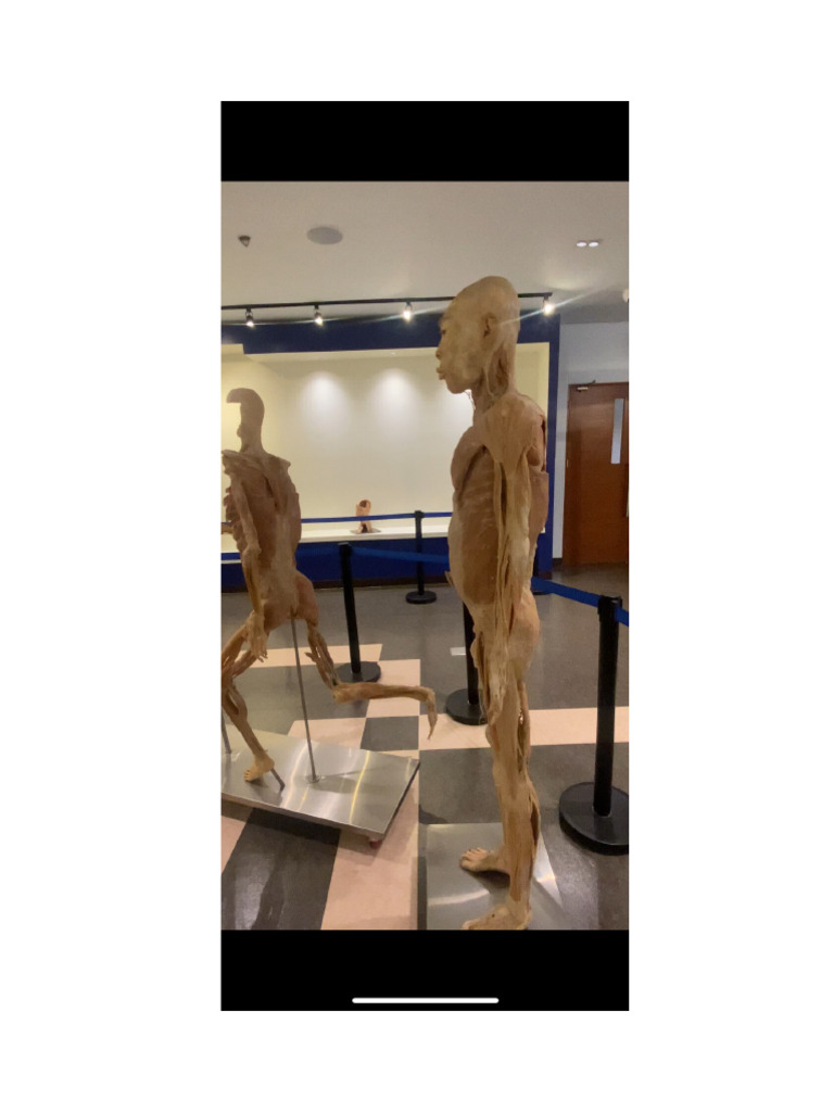 Anterior and Posterior | PDF