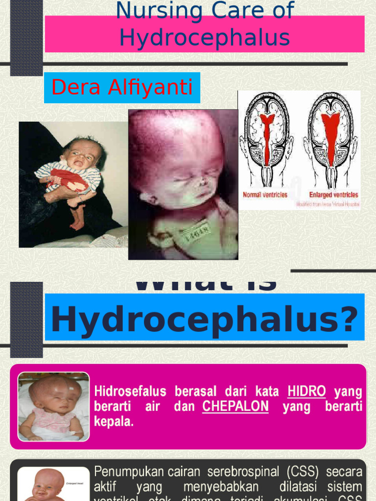 Hydrocephalus-1 | PDF