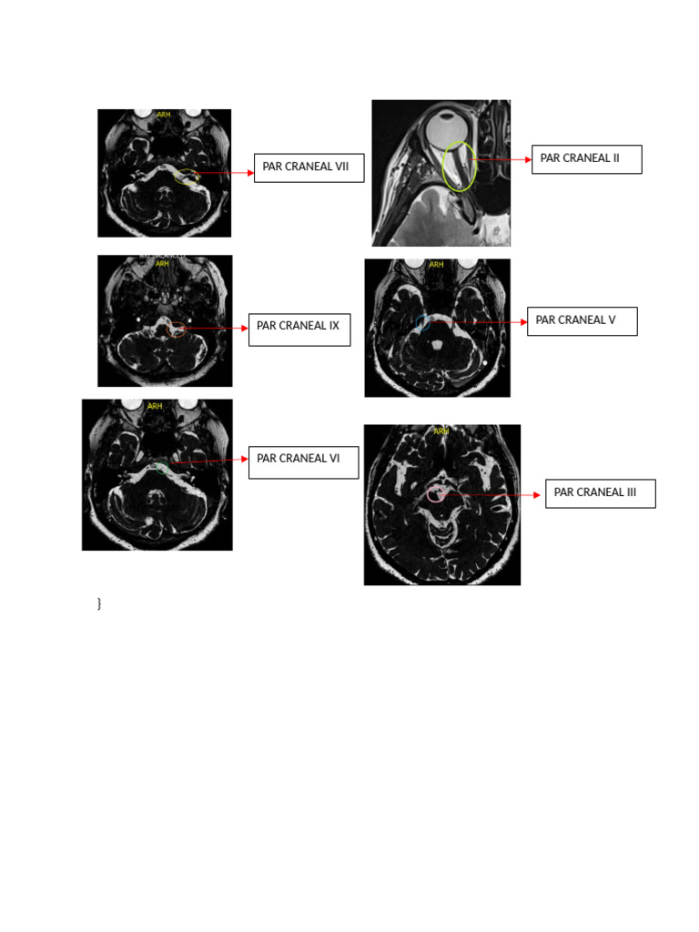 Anatomia Transversal | PDF