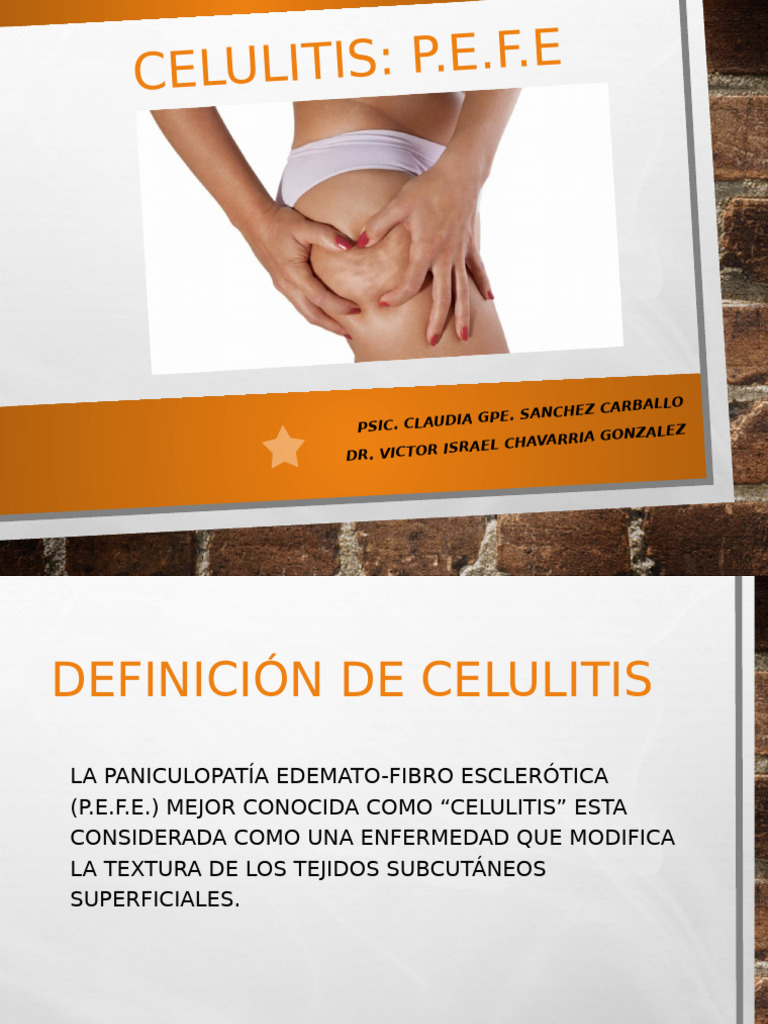 Celulitis | PDF