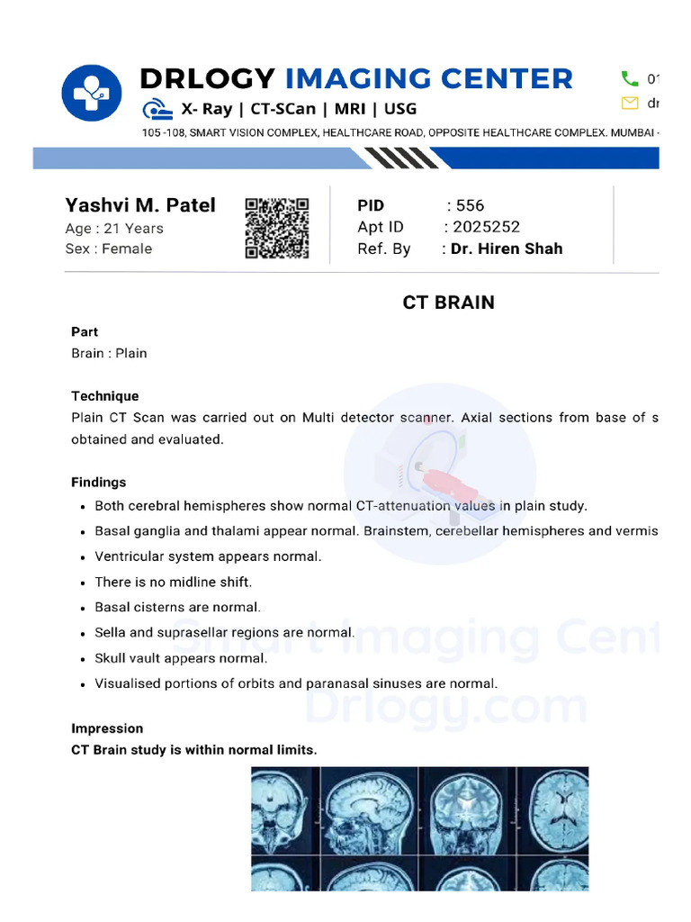 CT Brain Report Format - Drlogy - Webp (1414×2000) | PDF