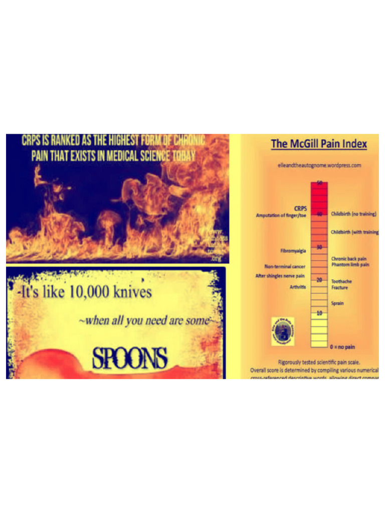 Chronic Regional Pain Syndrome (CRPS) | PDF
