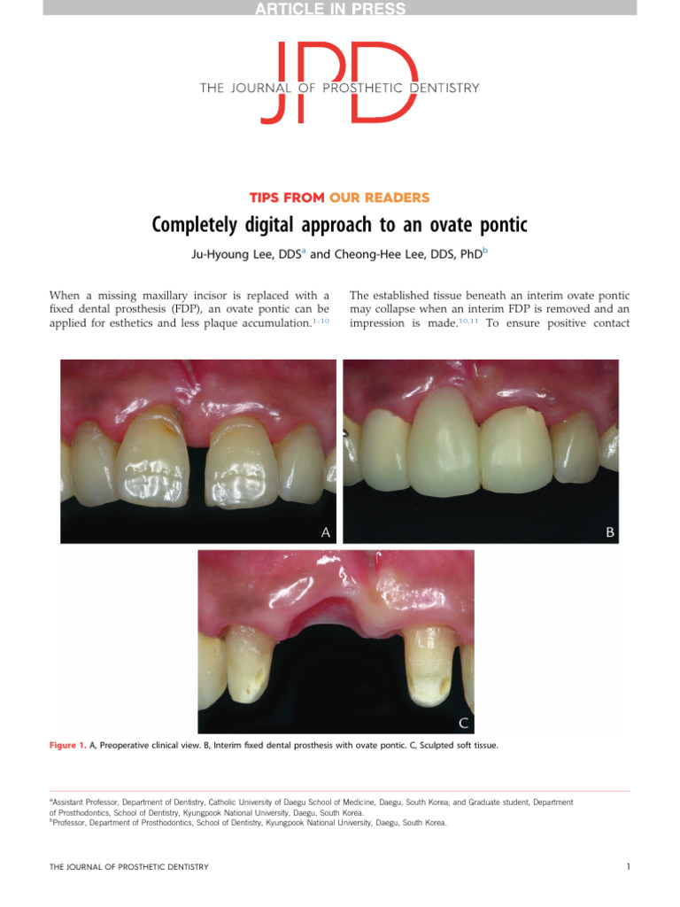 Lee. Completely Digital Approach To An Ovate Pontic | PDF