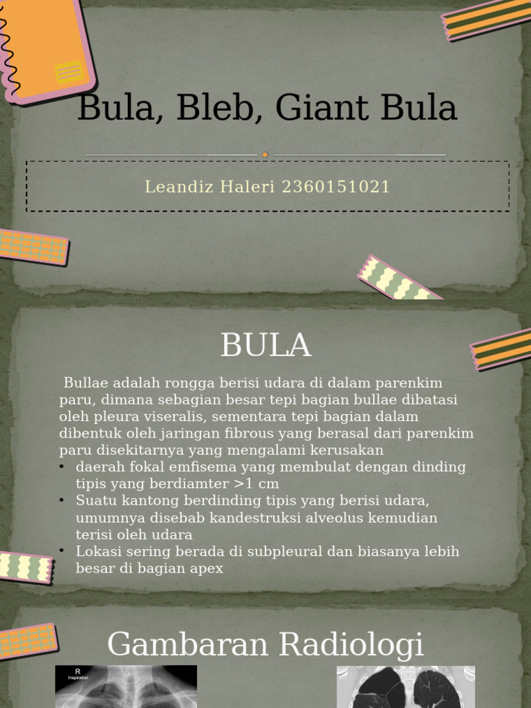 22 - Bula, Bleb, Giant Bula - Leandiz Haleri - 2360151021 | PDF