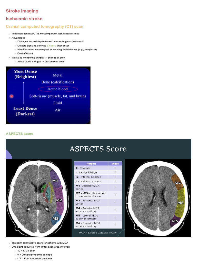 Stroke Imaging | PDF