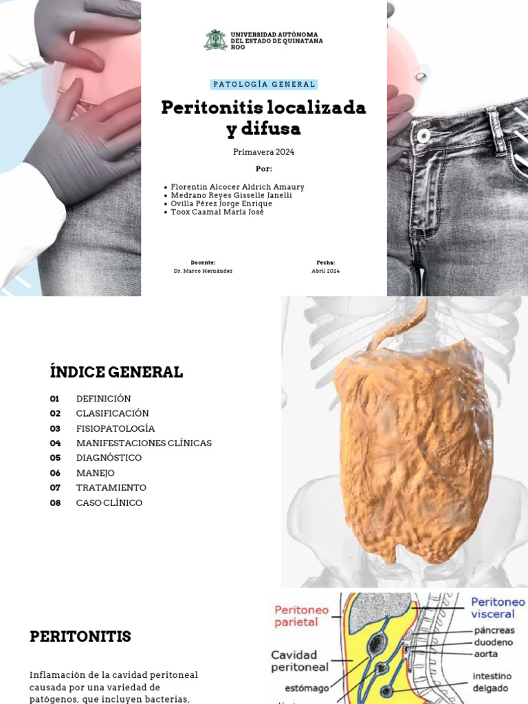 Equipo 1 - Peritonitis Localizada y Difusa | PDF | Septicemia | Especialidades Medicas