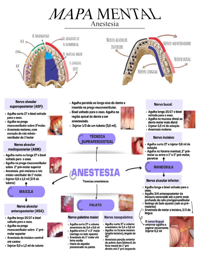 Mapa Mental Anestesia. | PDF
