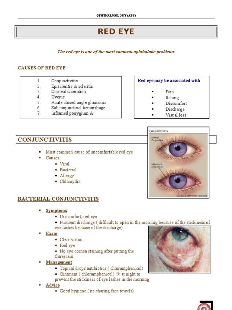 Red Eye | PDF | Eye | Epidemiology