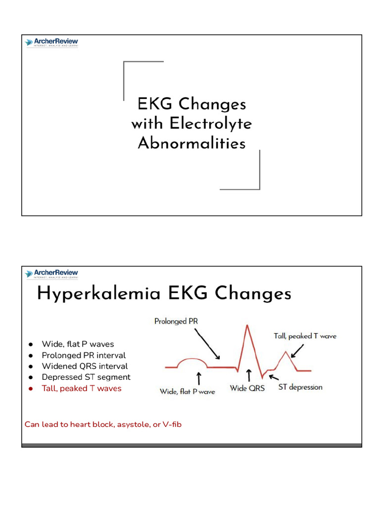 EKG With Electrolyte Abnormalities | PDF