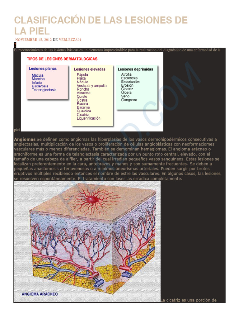 Lesiones de La Piel | PDF