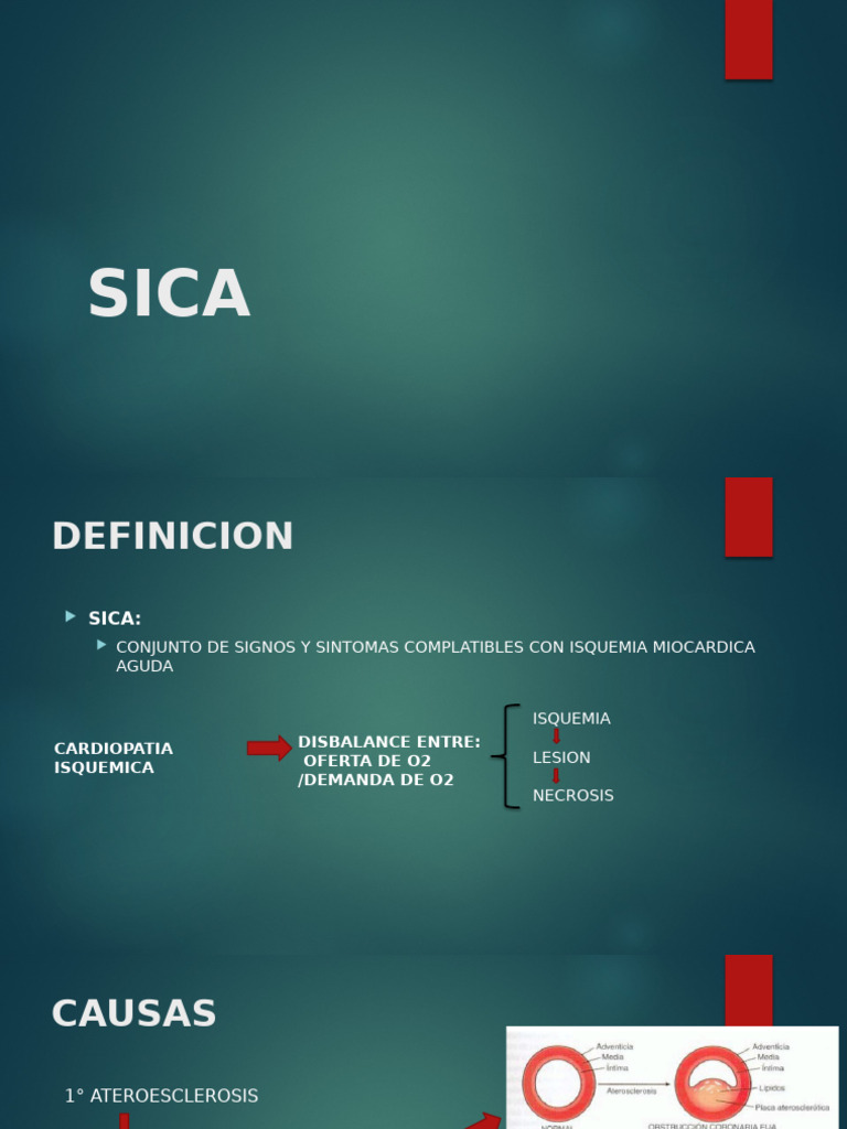 SICA | PDF | Isquemia | Enfermedades y trastornos humanos