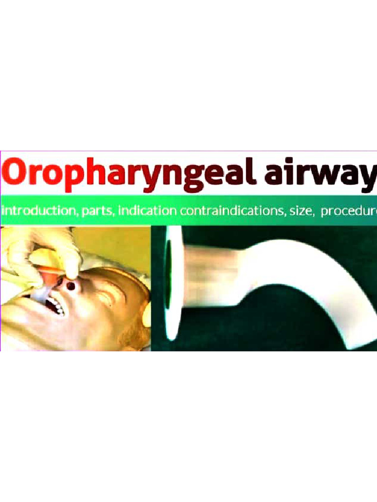 Oropharyngeal Airway and Nasopharyngeal Airway | PDF