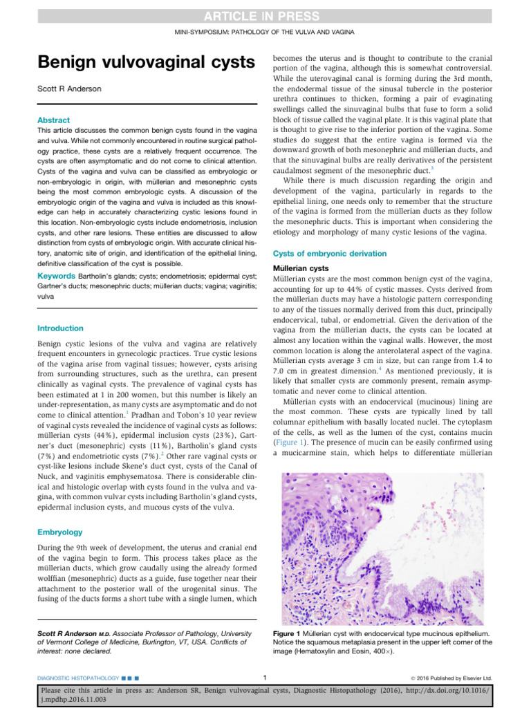 Benign Vulvovaginal Cysts | PDF