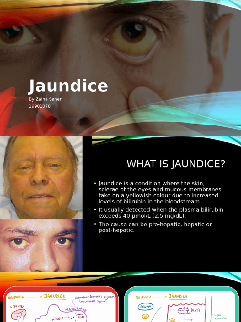 Jaundice Int Med | PDF