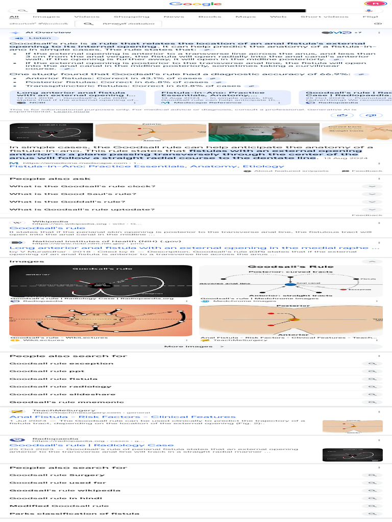 Goodsall Rule - Google Search | PDF