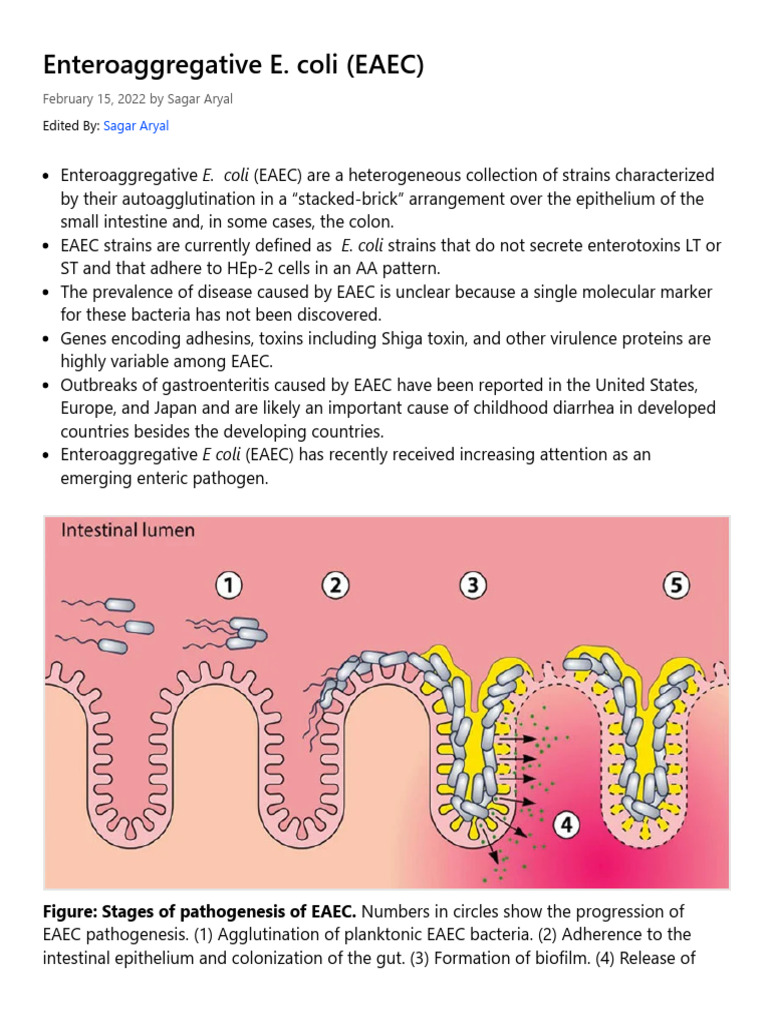 Enteroaggregative E. Coli (EAEC) | PDF