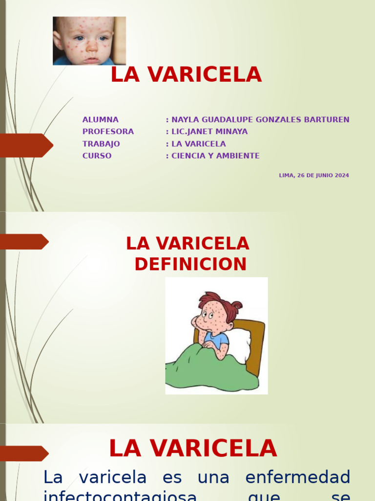 La Varicela | PDF