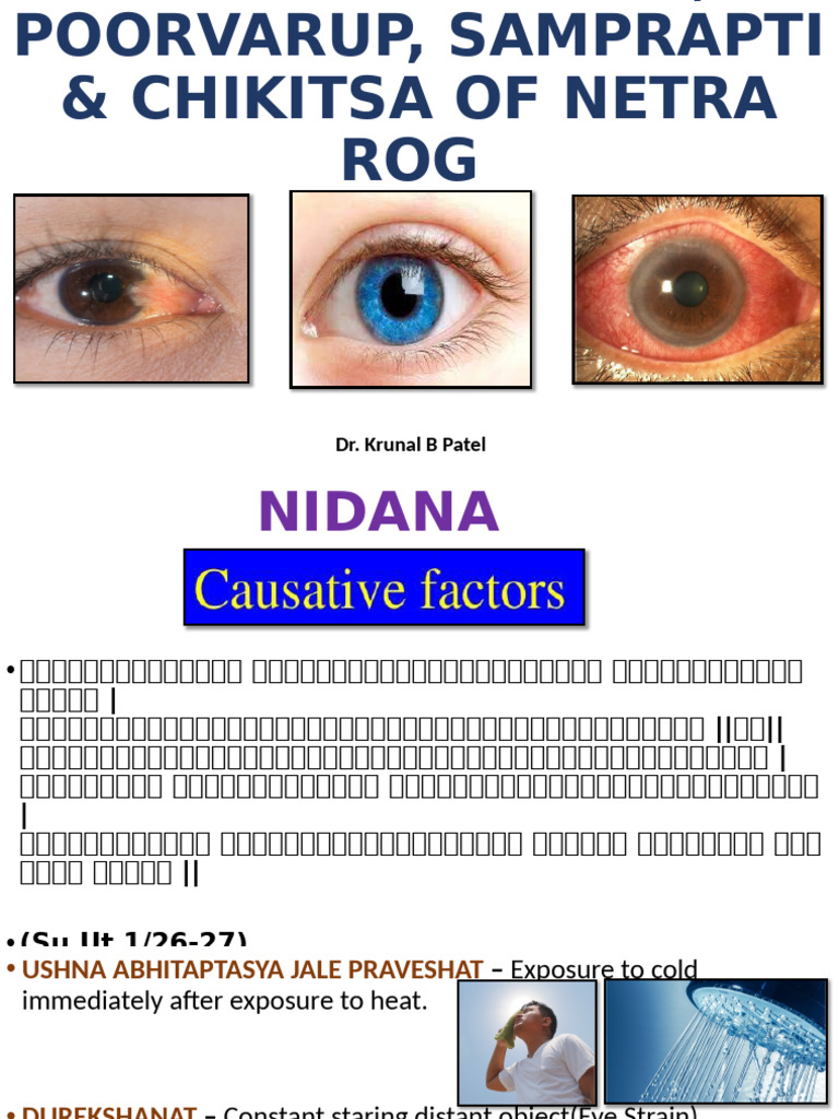 Samanya Nidan of Netra Rog | PDF