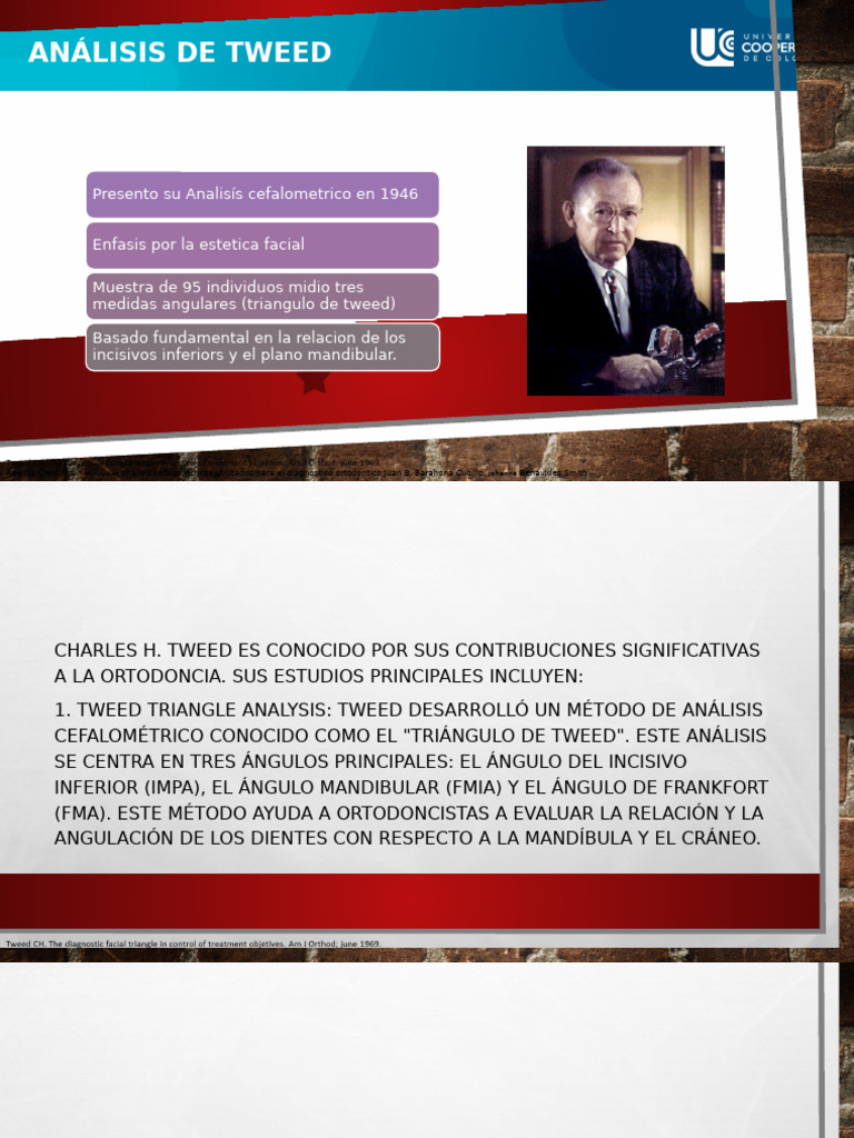 Analisis de Cefalometria de Tweed | PDF