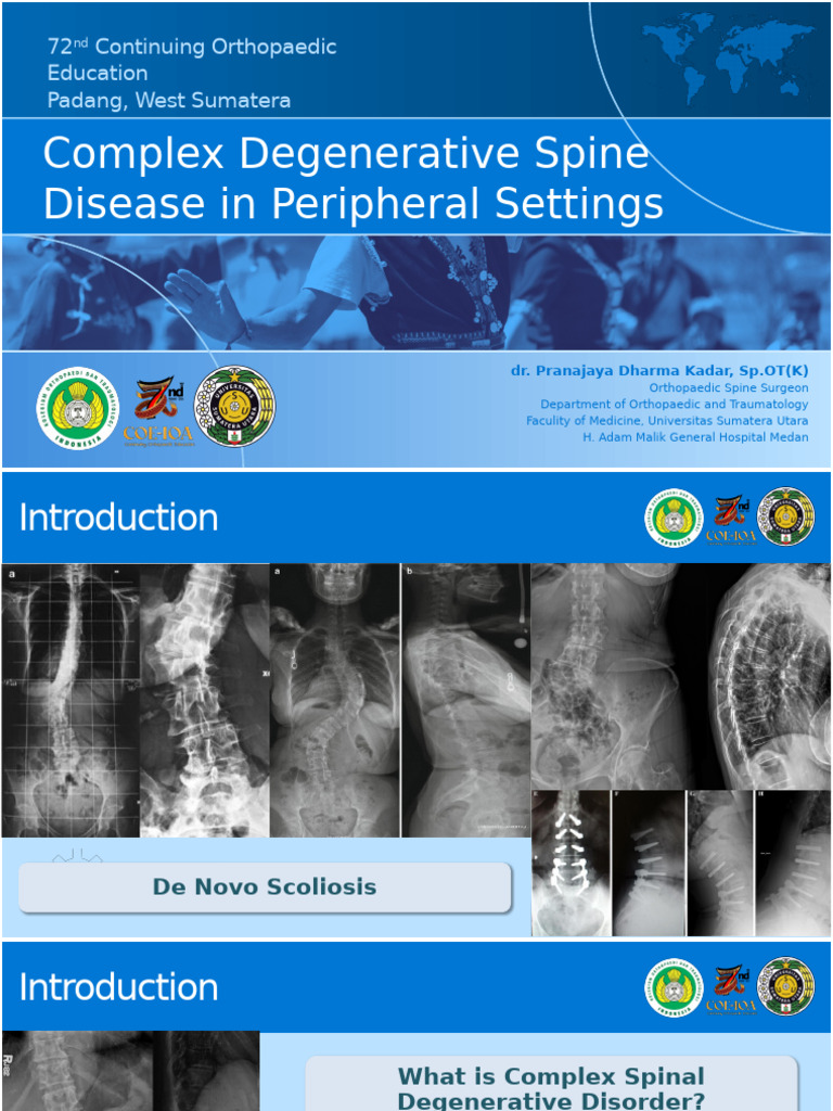 Complex Degenerative Spine Disease in Peripheral Setting PPT5 | PDF