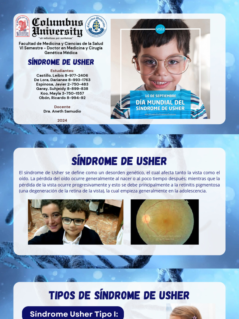 Síndrome de Usher - Genética Médica | PDF