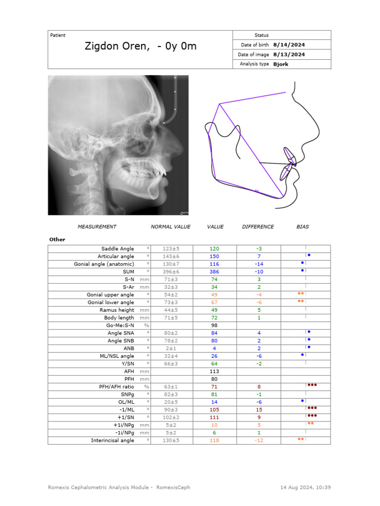 Oren Zigdon Analysis | PDF