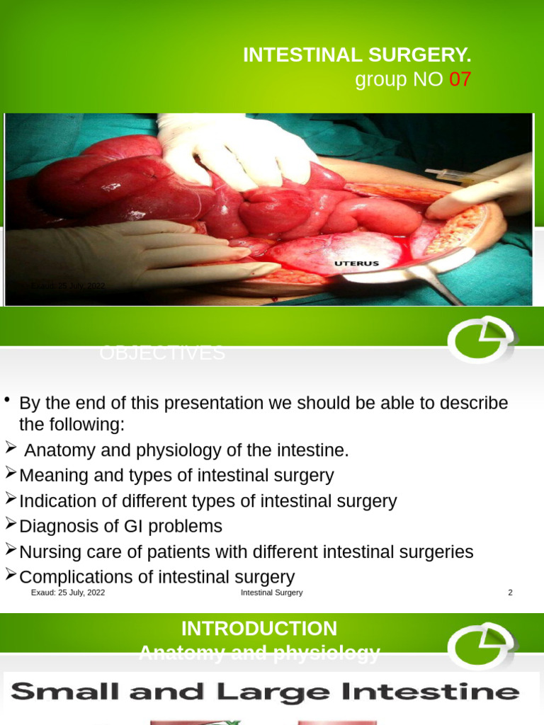 Intestinal Surgery | PDF