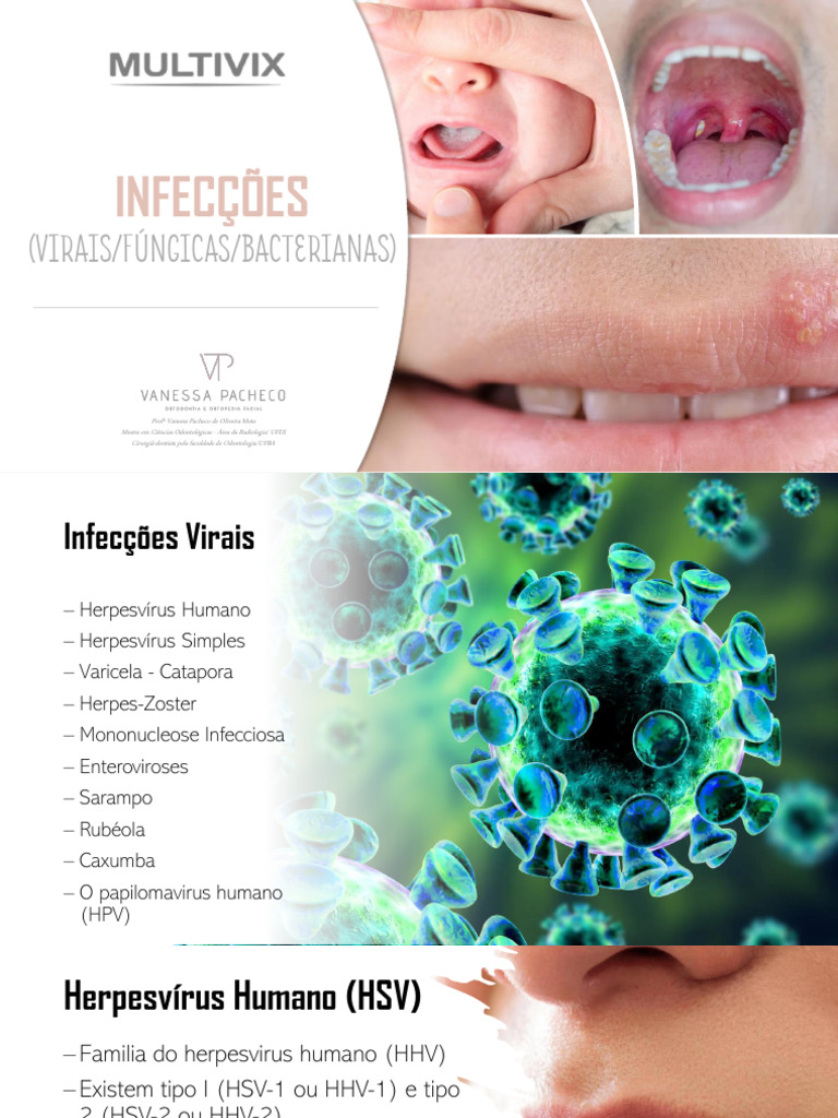 Infecções Virais, Bacterianas e Fungicas | PDF