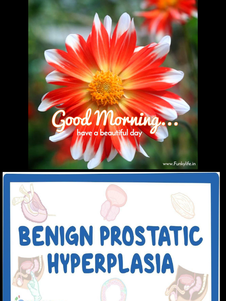 Benign Prostatic Hyperplasia (BPH) | PDF