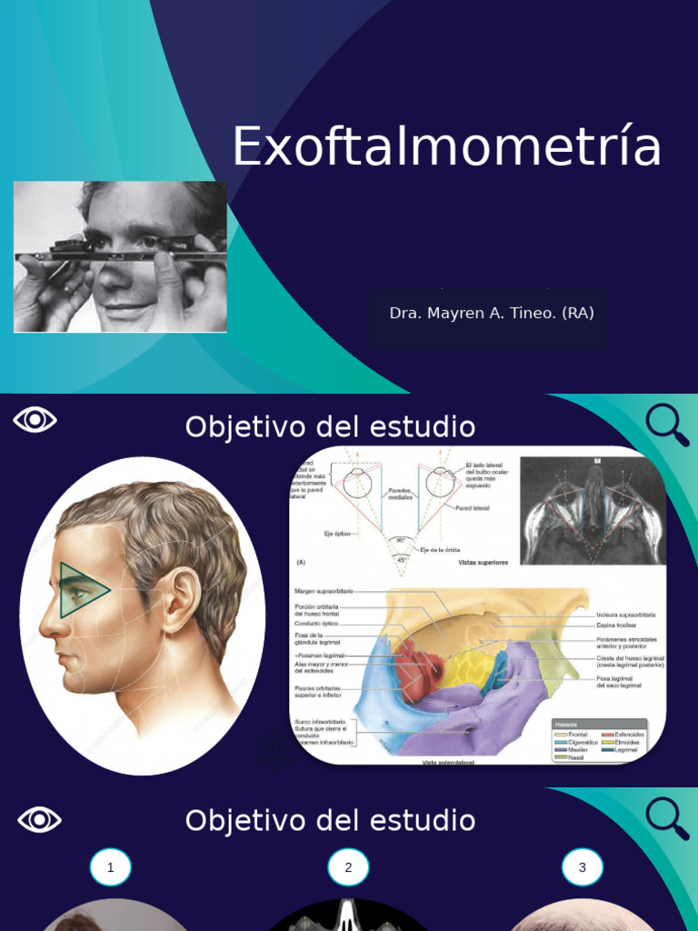 Exoftalmometría | PDF