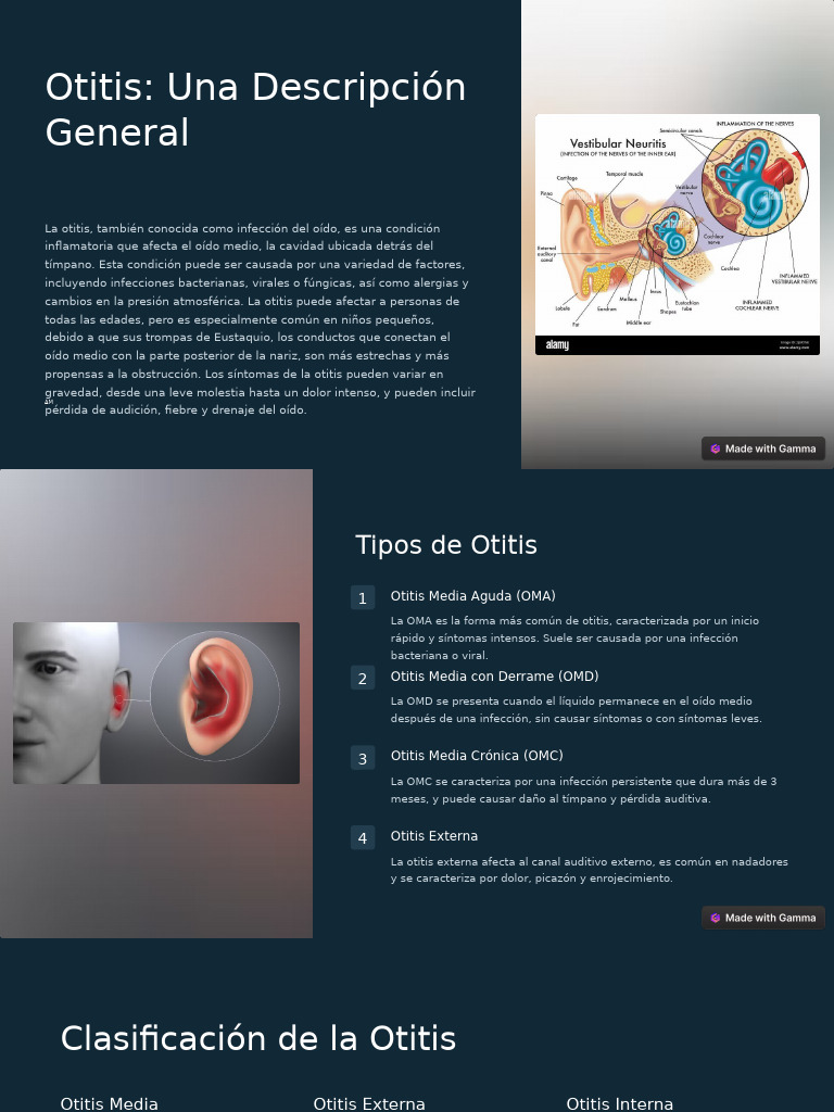 Otitis | PDF