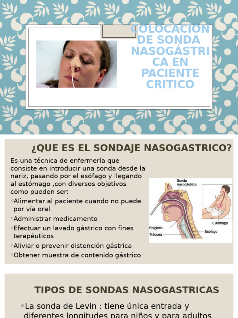 Colocacion De Sonda Nasogástrica Pdf
