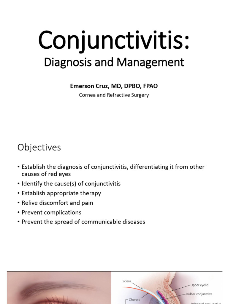 Conjunctivitis MCU | PDF
