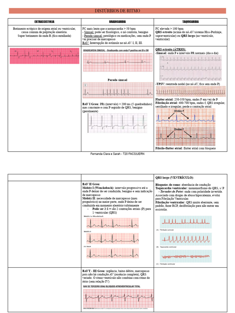 Resumo ECG em Tabela | PDF | Eletrocardiografia | Átrio (coração)