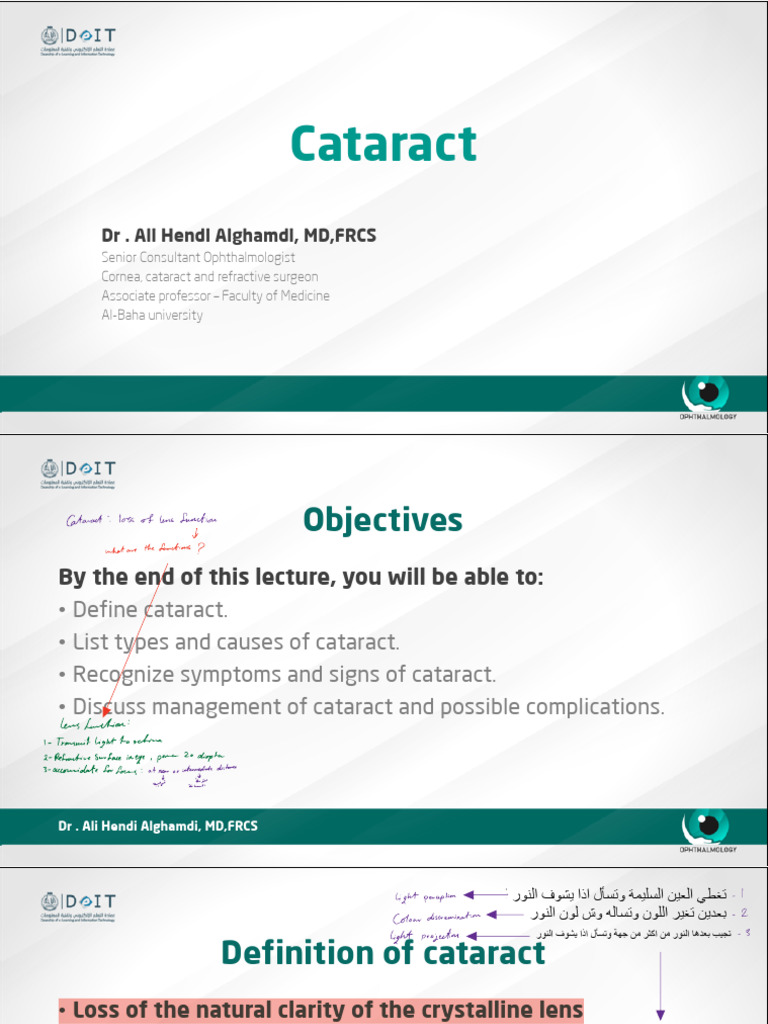 Cataract | PDF