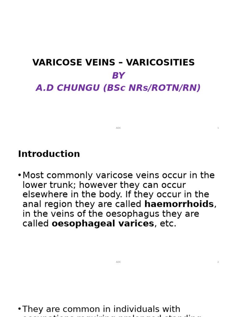 Varicose Veins – Varicosities | PDF