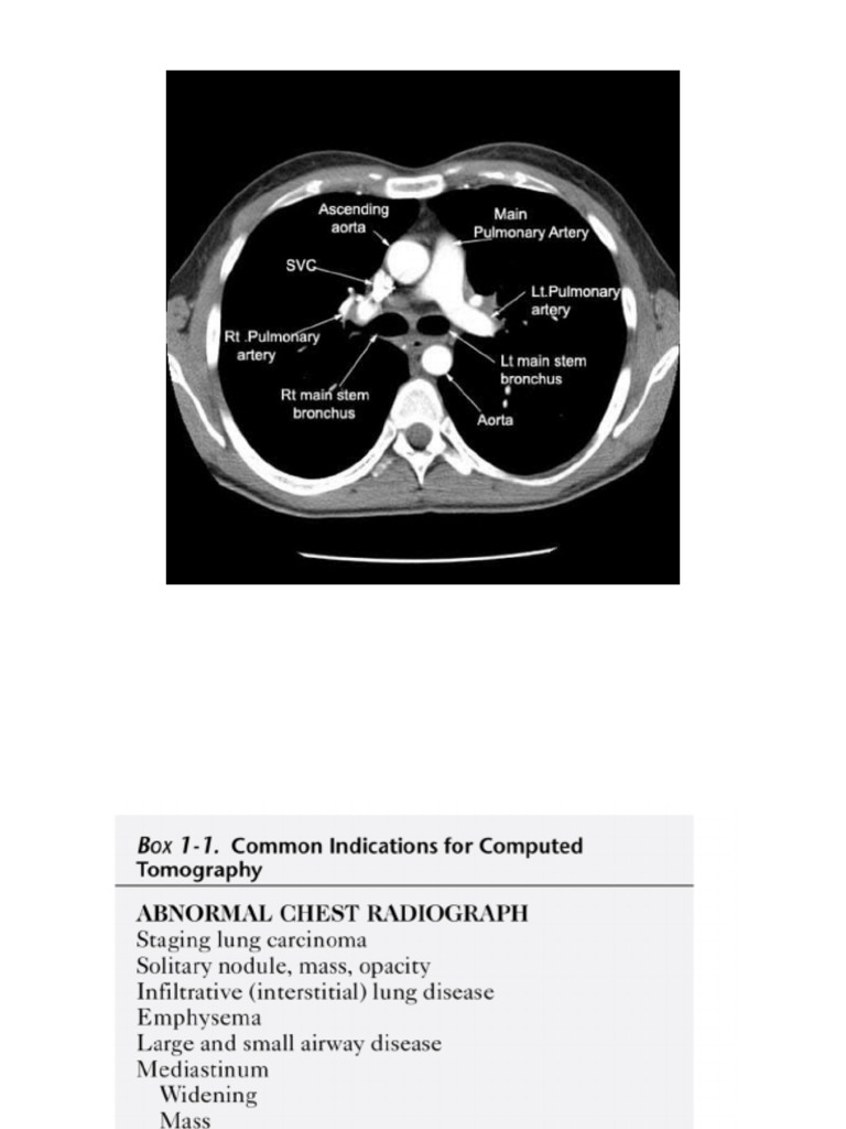 CT Chest | PDF