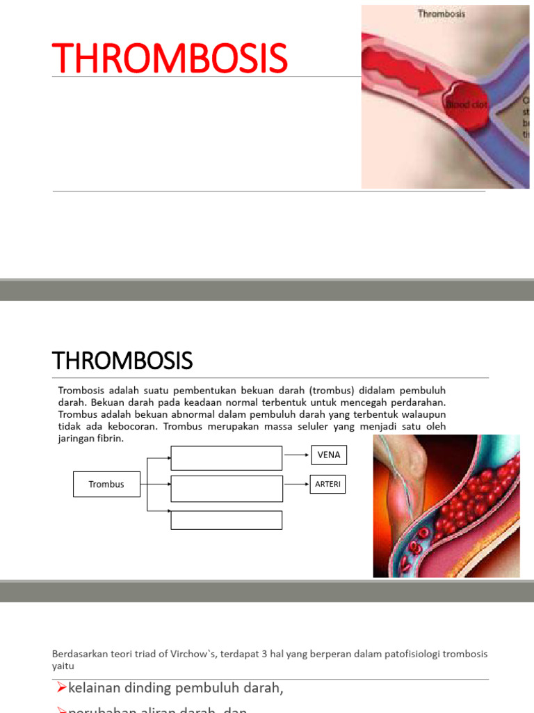 Trombus Dan Emboli | PDF