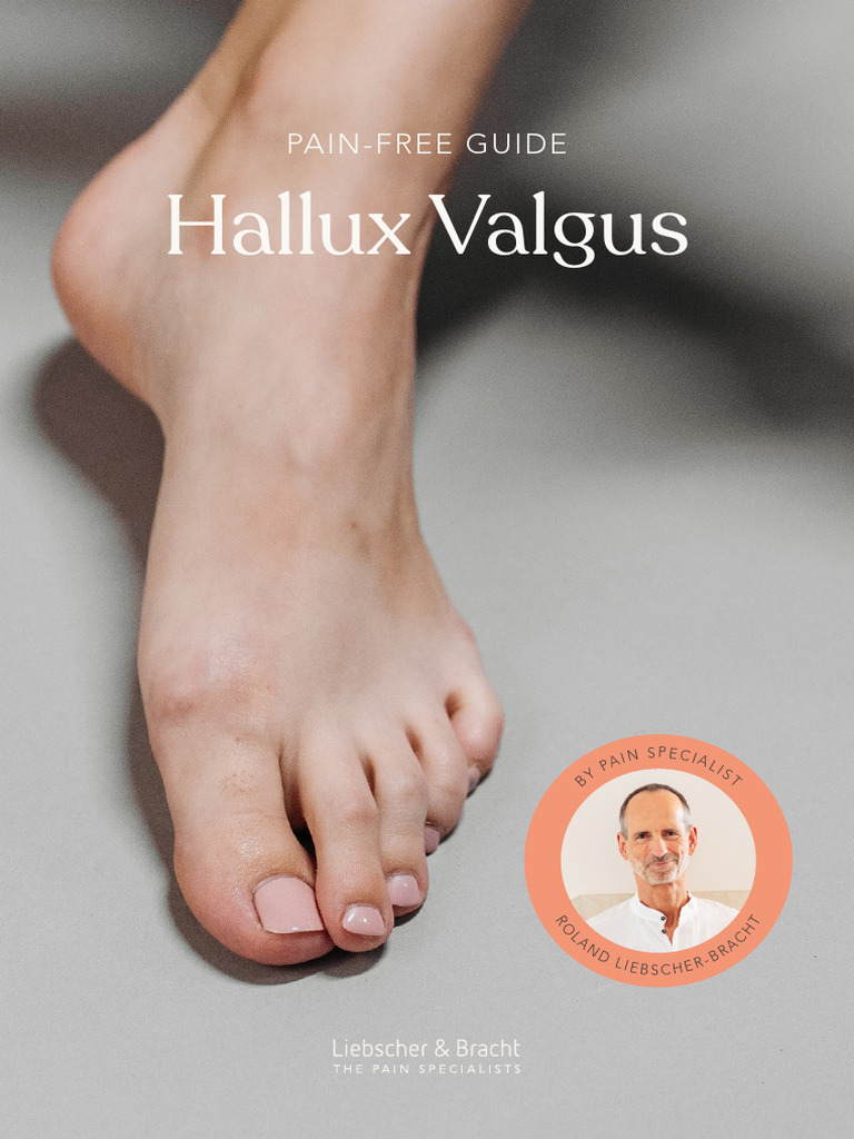 Hallux_Valgus | PDF