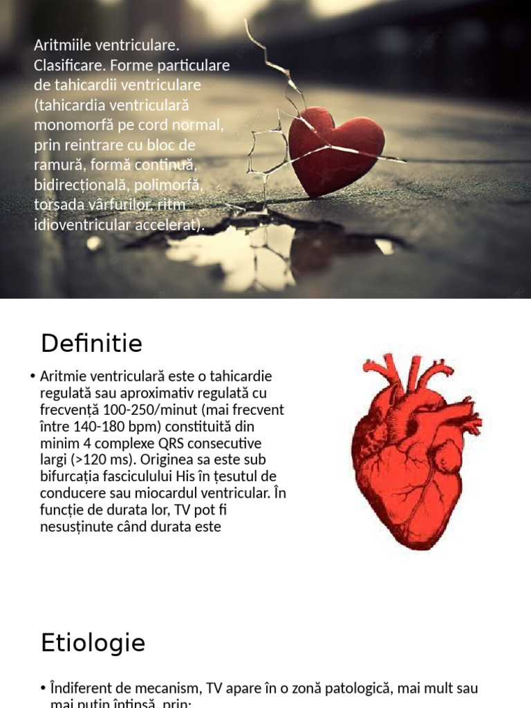 Aritmii Ventriculare | PDF