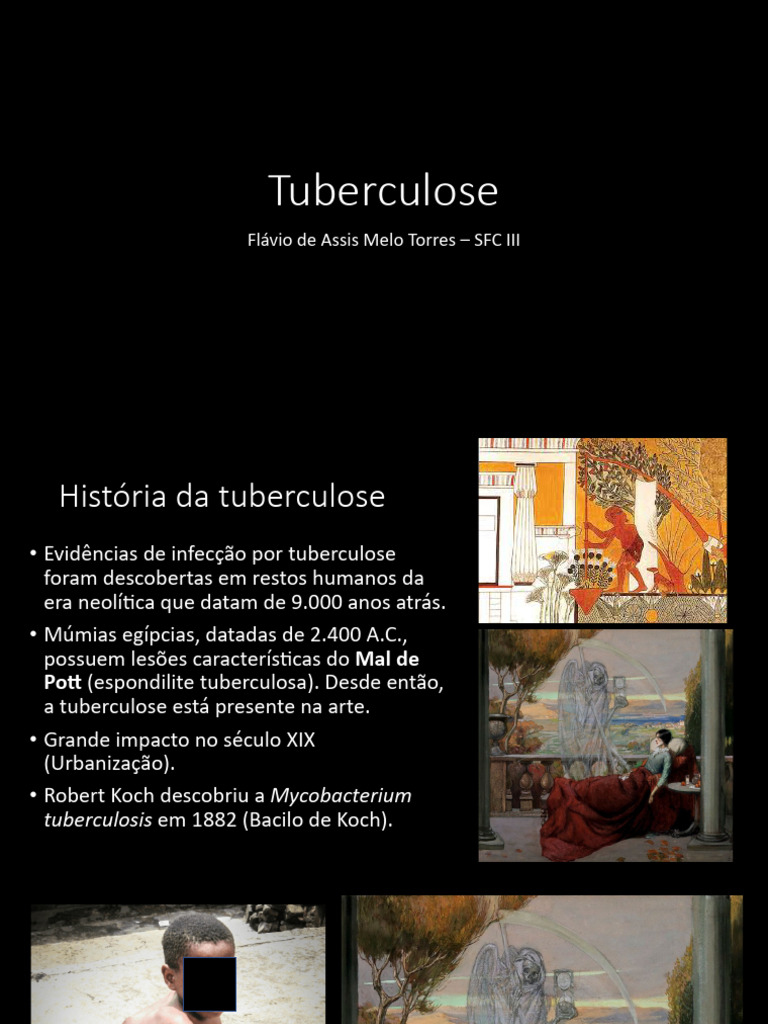 Aula Tuberculose | PDF