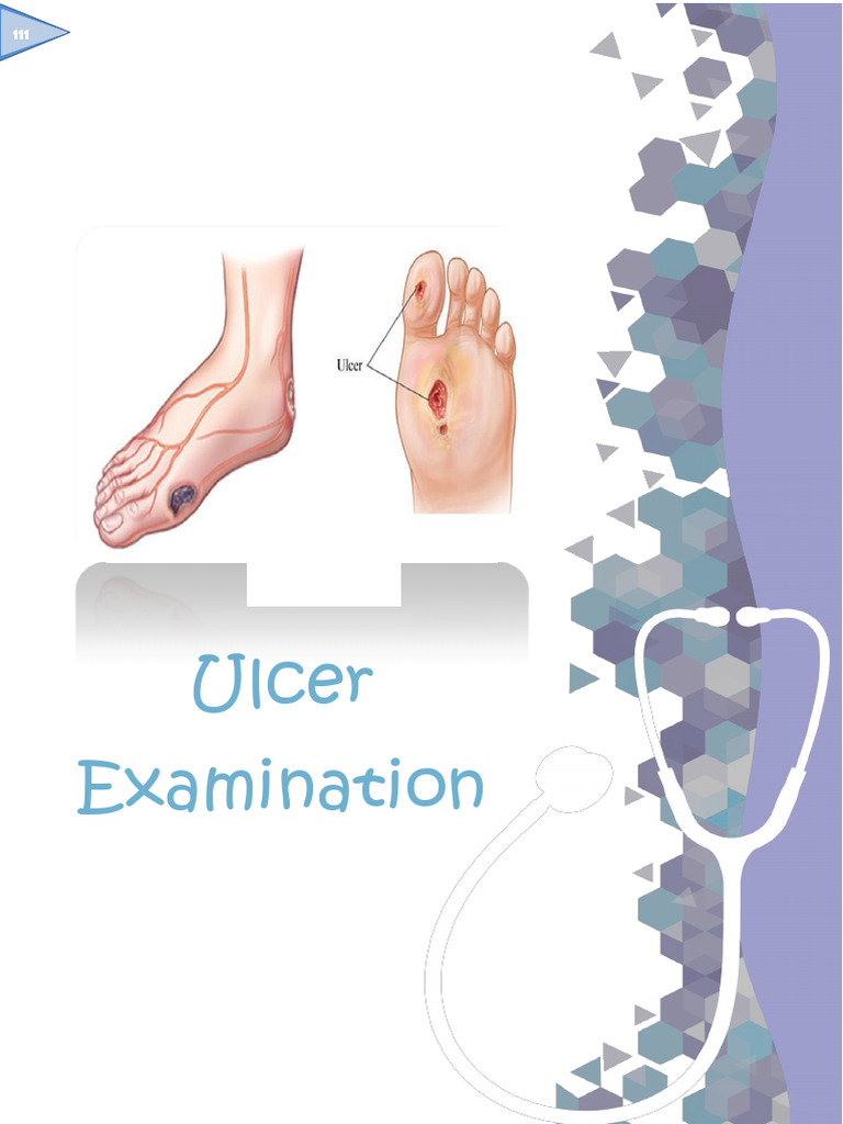 3 - Ulcer Examination | PDF