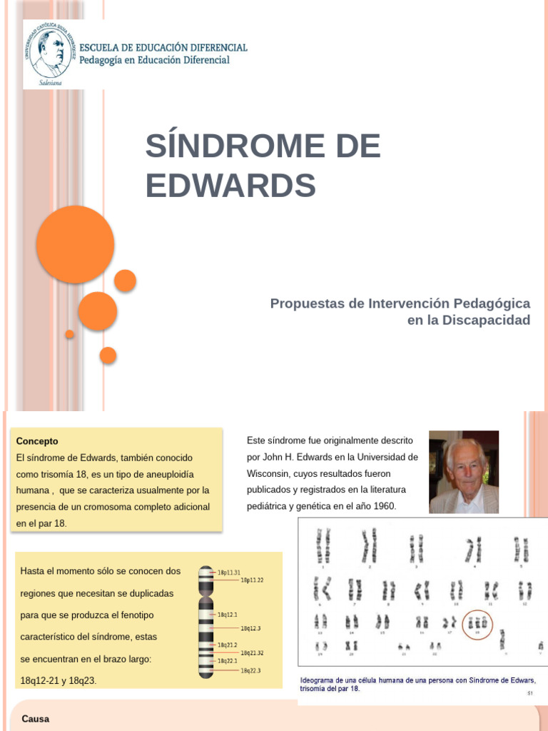 Síndrome de Edwards | PDF | Especialidades Medicas | Enfermedades y trastornos