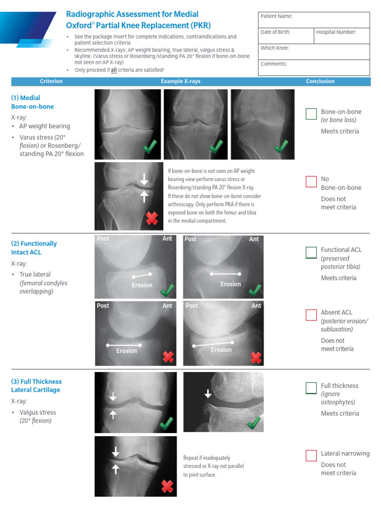 Oxford-Decision-Aid-Flyer For UKA | PDF