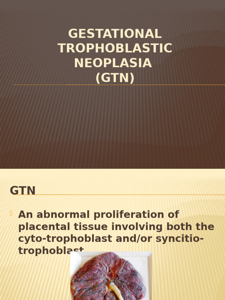 1gestational Trophoblastic Neoplasia GTN | PDF | Medical Specialties ...