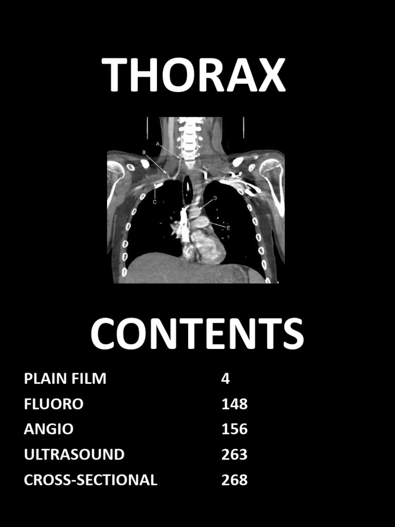 Thorax | PDF