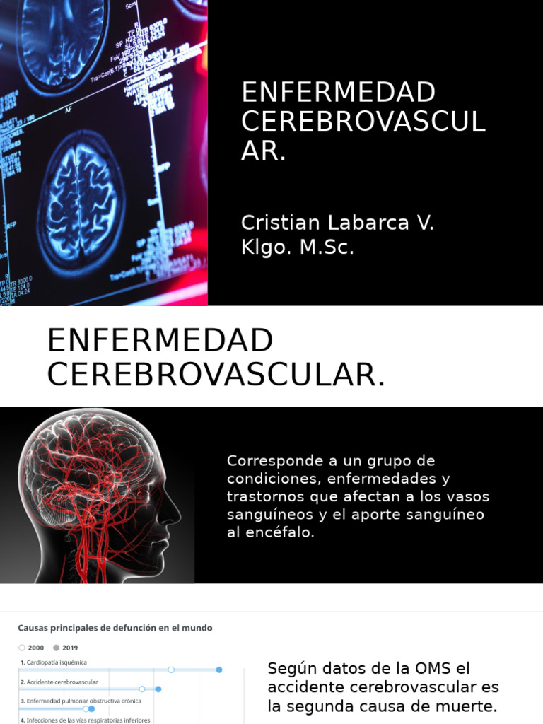 Enfermedad Cerebrovascular | PDF