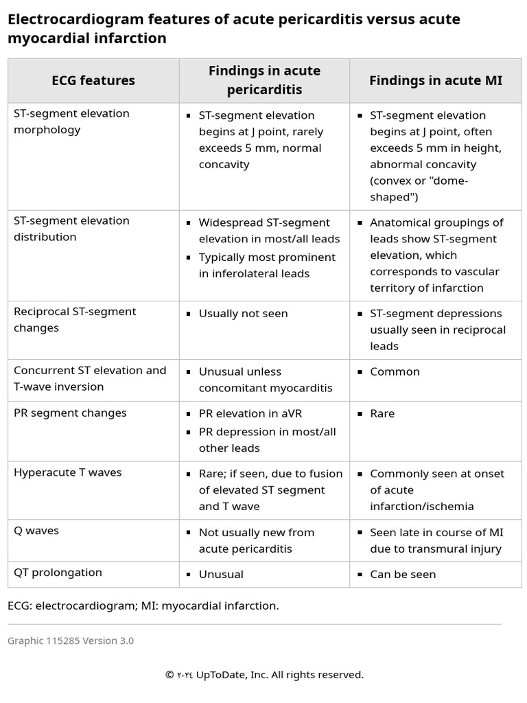 Electrocardiogram Features of Acute Pericarditis Versus Acute Myocardial Infarction | PDF