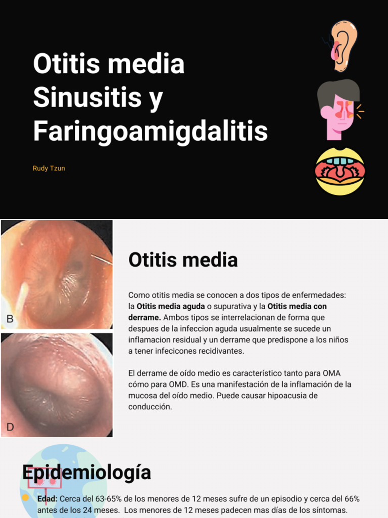 Clase Otitis | PDF