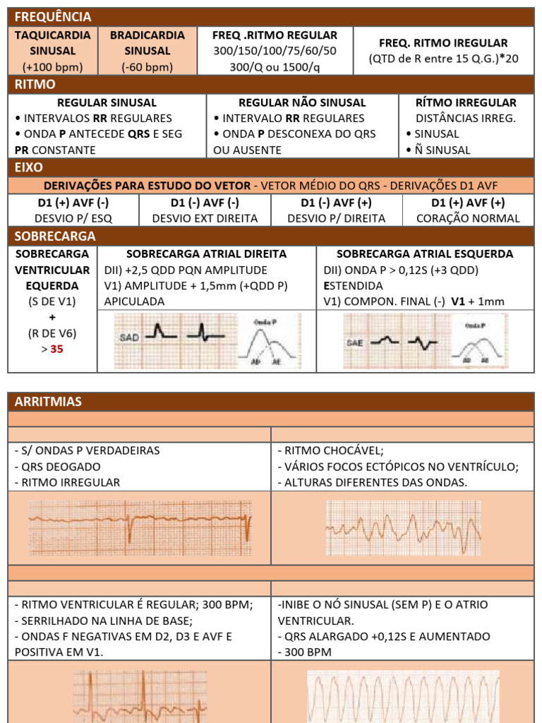 ECG - CARDS | PDF